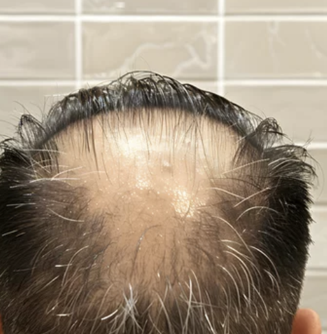 Ruby – Creation Of Beauty